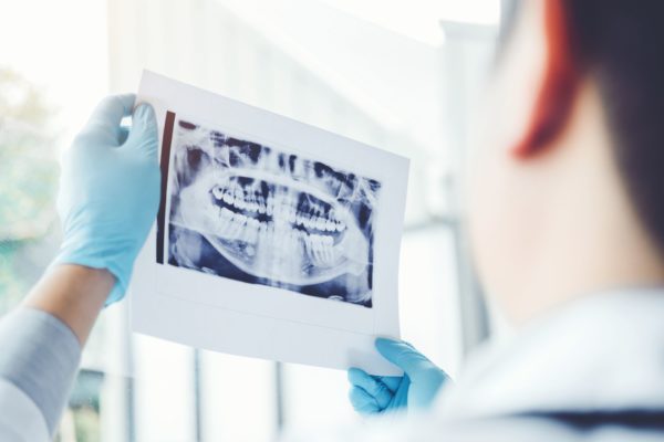 Why Test the Vitality of Tooth Pulp? - Greeley, CO Dentist
