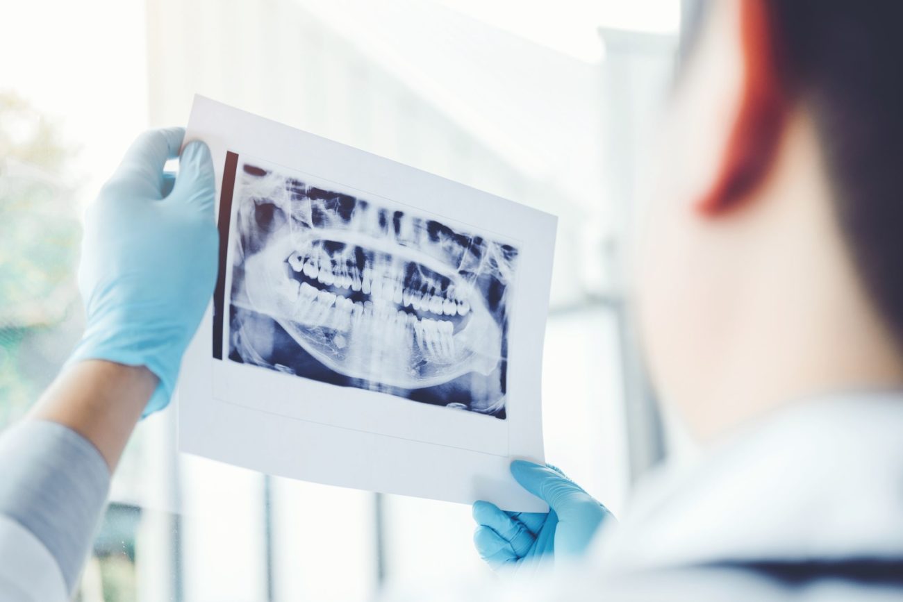 Why Test the Vitality of Tooth Pulp? - Greeley, CO Dentist