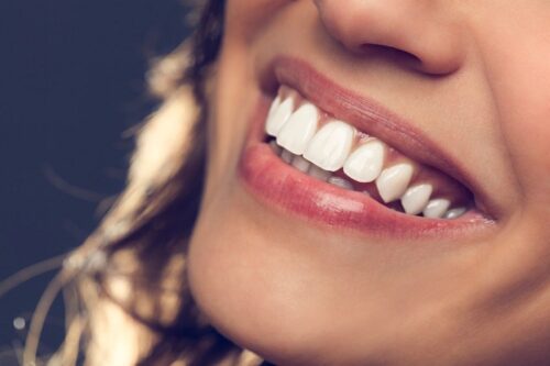 Why Fix Your Smile Alignment? - Greeley, CO Cosmetic Dentist
